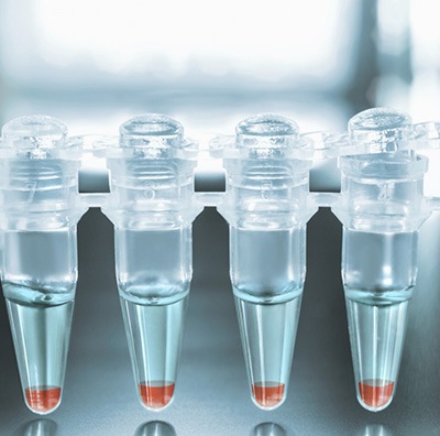 Фемофлор в Челябинске. Анализ на половые инфекции. Фемофлор-скрин ...